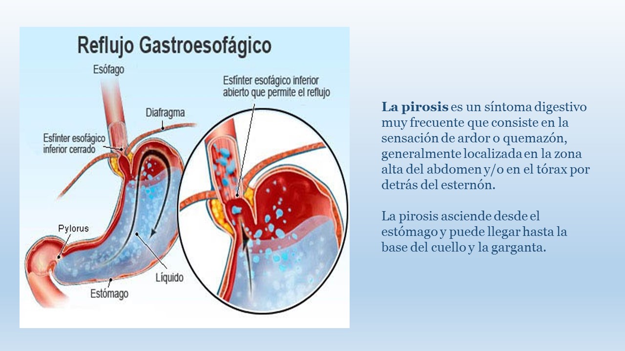 Fisiopatologías en el estado gestacional-neonatal del sistema digestivo ...
