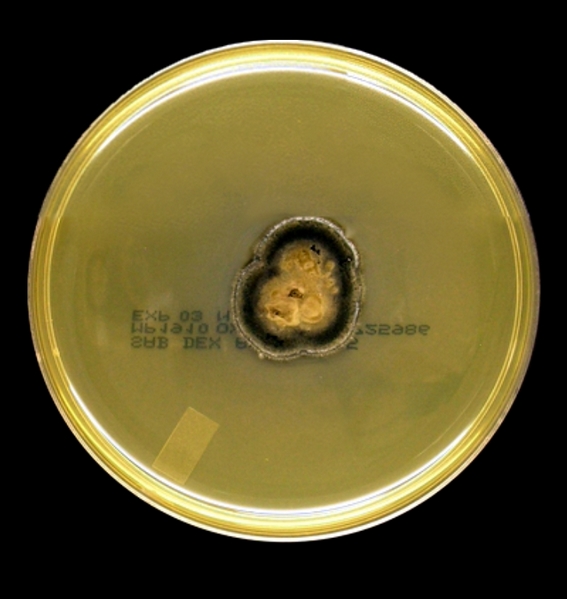 Fun With Microbiology (What's Buggin' You?): Fonsecaea pedrosoi/monophora