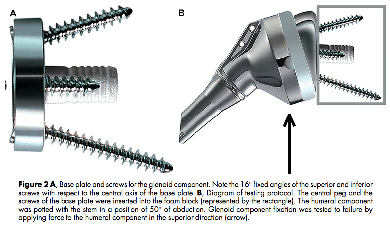 UW Shoulder and Elbow Academy: Reverse total shoulder - safe baseplate ...