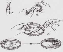 Microbiología: Técnicas y Métodos de estriado en caja y tubo (medios de ...
