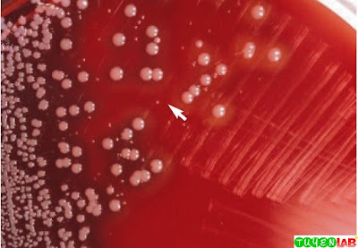 Haemophilus Influenzae Satellitism