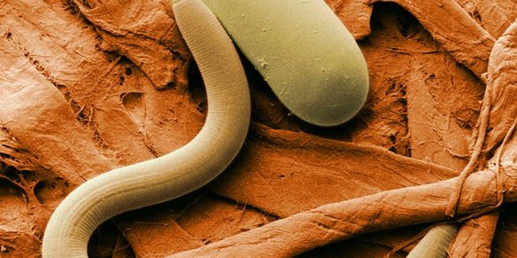 Gliste kod djece – uzroci, simptomi i liječenje ~ Prirodno@Zdravo