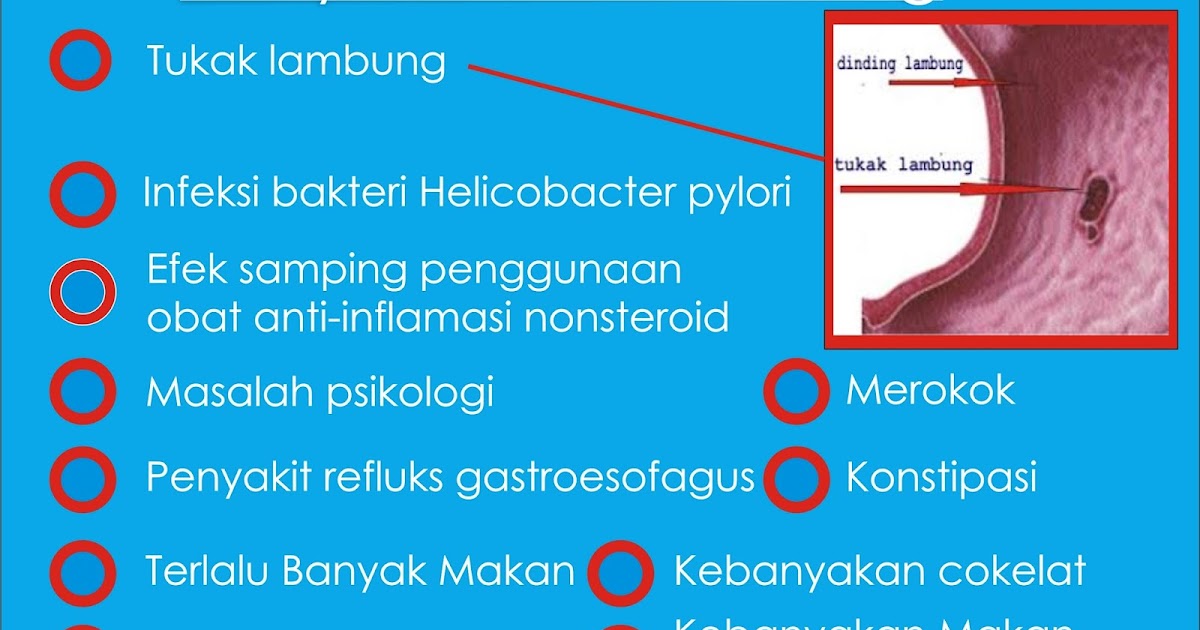sharing Sakit Maag