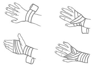 A enfermeira na casa: ¿Cómo hacer un vendaje?