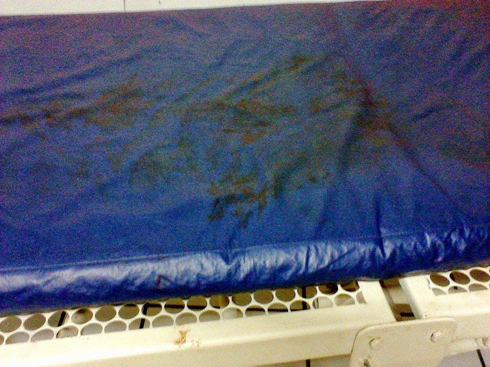 Blog do Alexandre: HAPA: Paciente Operada Quase Morre ao Cair de Cama ...