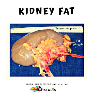 Kidney Fat