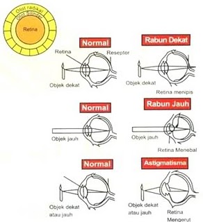 ANWAR OPTIC : MATA CYLINDRIS (SILINDER)