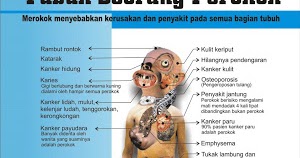 10 Dampak Buruk Akibat Merokok