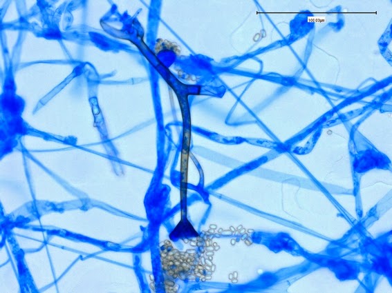 Fun With Microbiology (What's Buggin' You?): Apophysomyces elegans ...