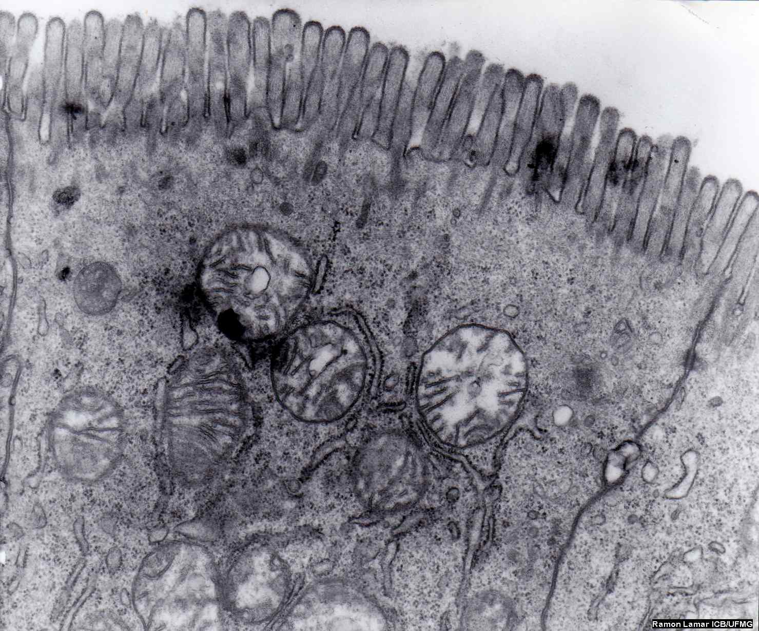Blog do Ramon Lamar: Imagens de Microscopia Eletrônica