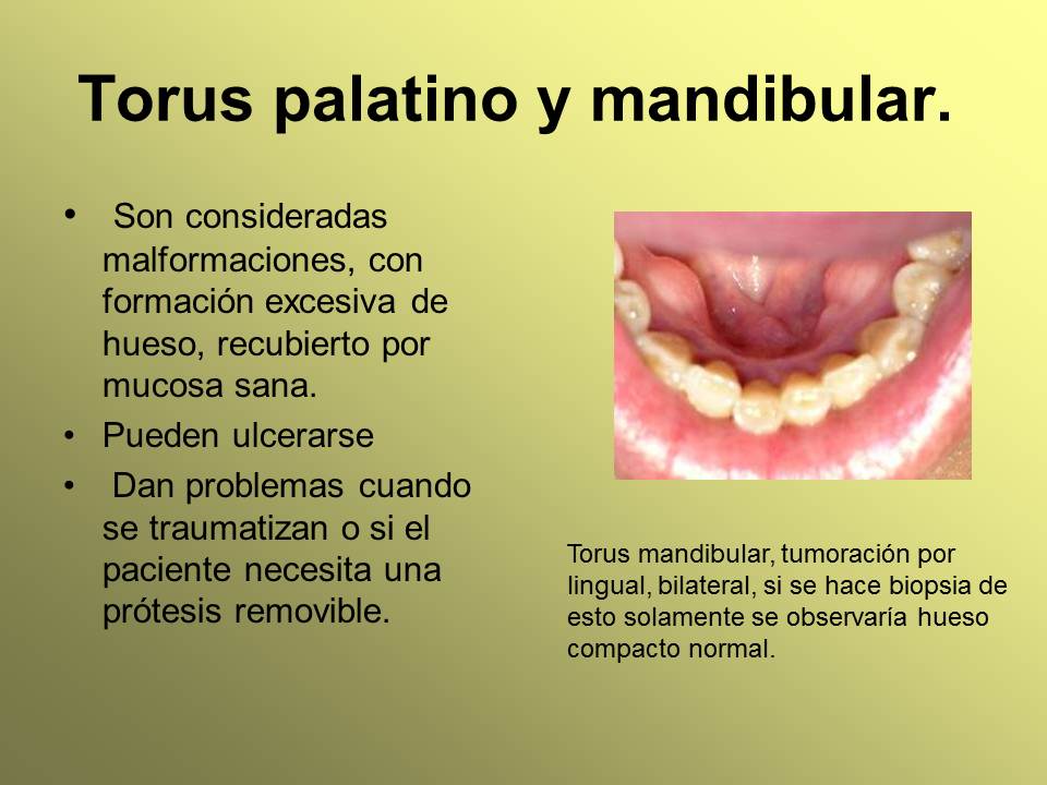 Radiología: Procesos Patológicos