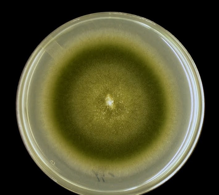 Fun With Microbiology (What's Buggin' You?): Curvularia sp.