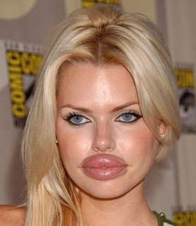 ALTERNATIVES TO A "LIP AUGMENTATION!"