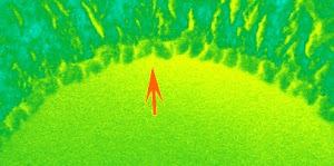 Modern & Multidimensional Iridology: Ulnar & Radial Loop