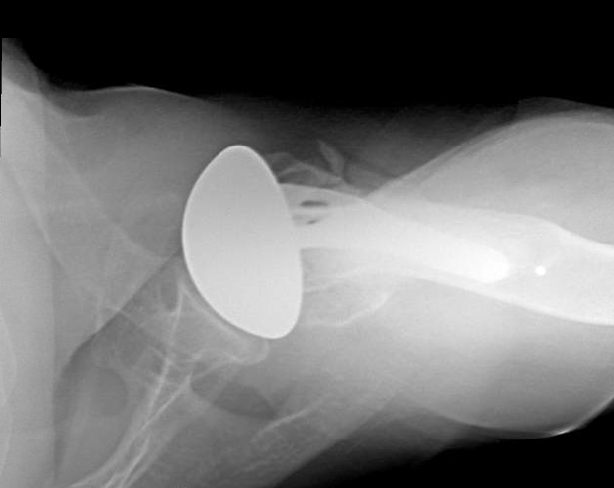 Shoulder And Elbow Surgery