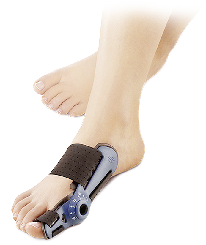 Prise en charge de son Hallux Valgus