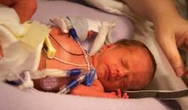 Dyslexia Untied: Newly approved drug Surfaxin® for infant Respiratory ...