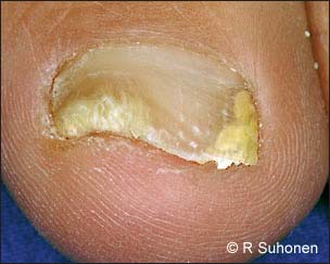 Minusta Kosmetologiksi: Jalkojen hoito