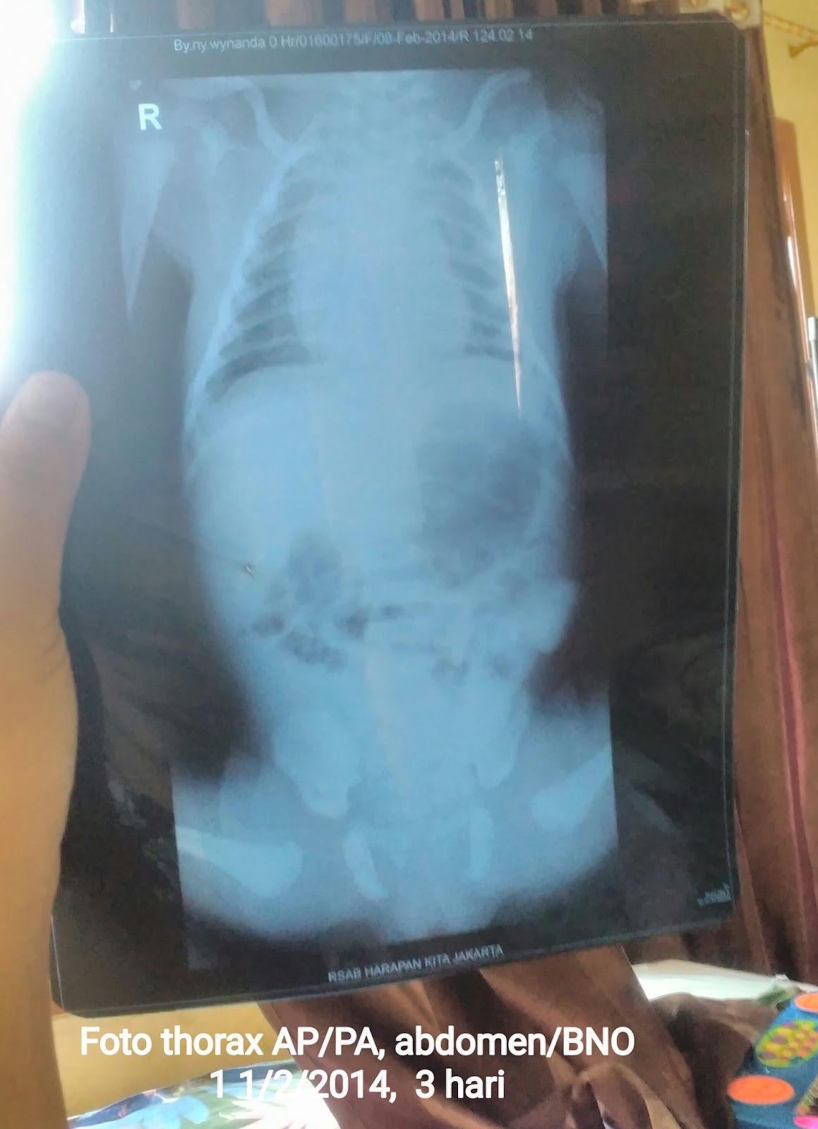 Mom2K's World: MESOCARDIA