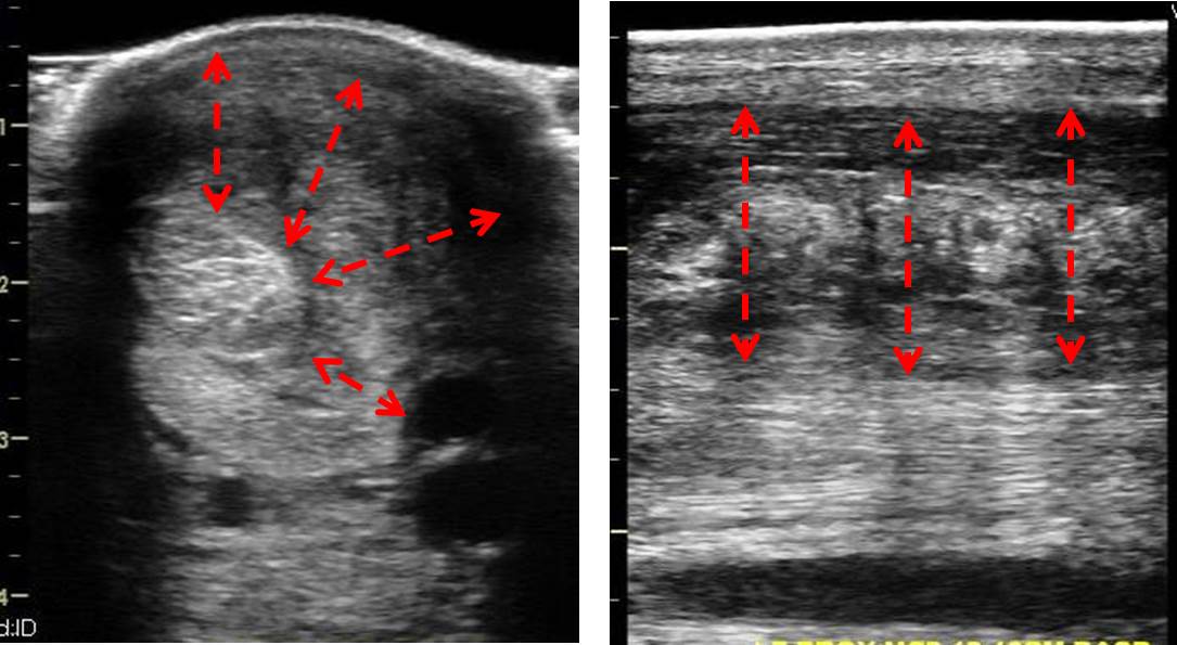Michael Porter, Equine Veterinarian: Superficial digital Flexor ...