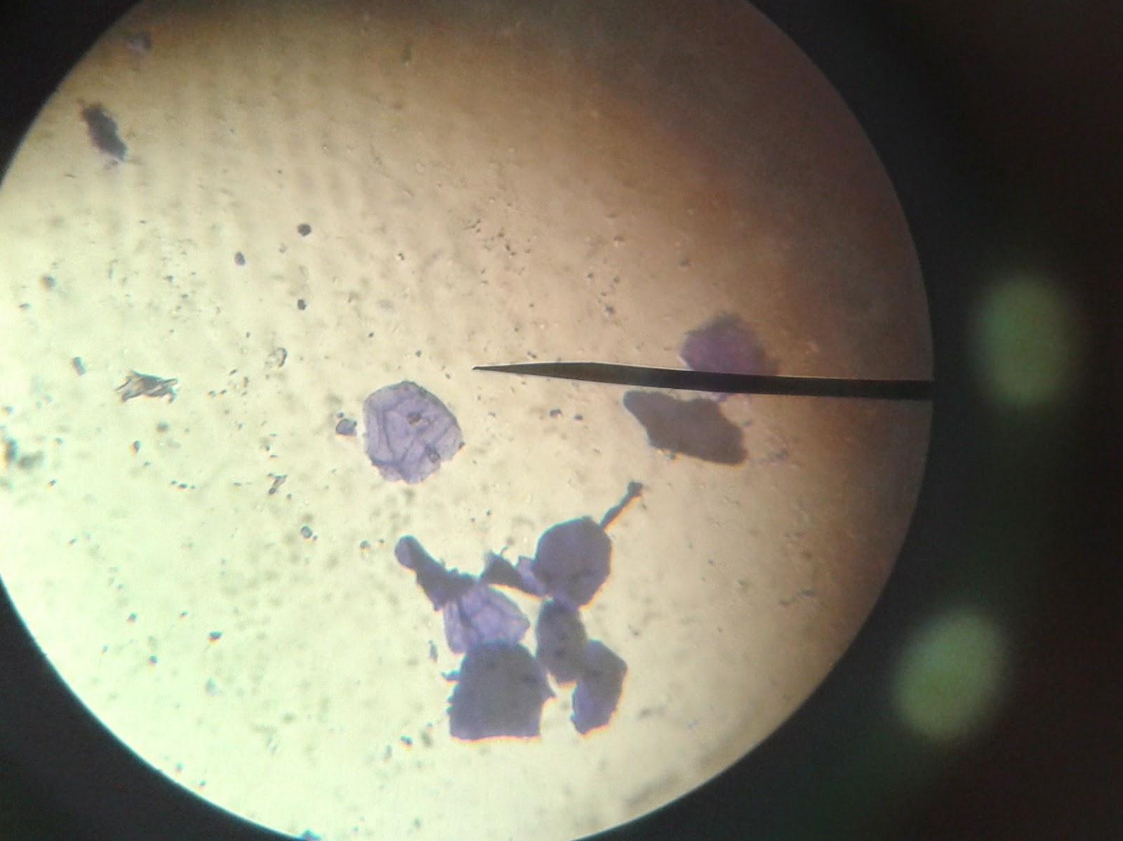 LE MICROSCOPE DU COLLÈGE WEILER (et la loupe monoculaire): MARDI 9 ...