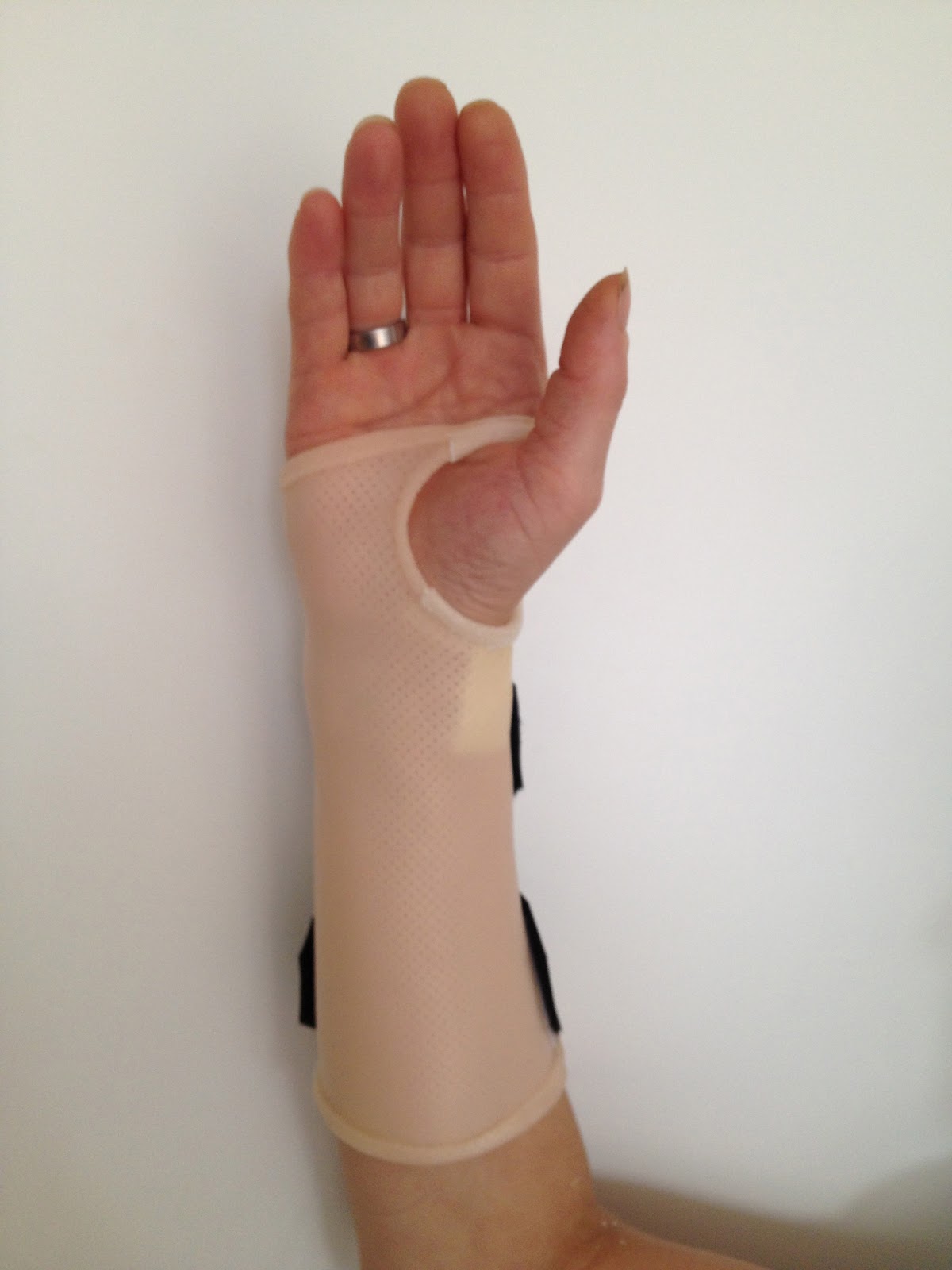 Orthèses sur mesure et appareillage personnalisé main poignet doigts ...