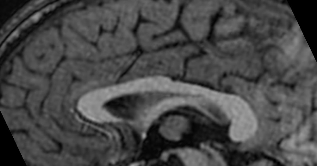 Ultimate Radiology : FRCR PART 1 : ANATOMY : 17