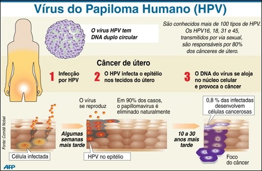 altonoticias10: SAÚDE - HPV: Entenda a doença e saiba como se prevenir