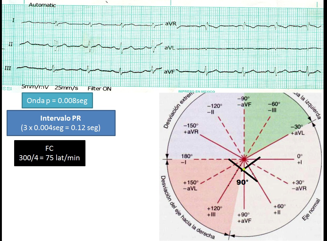 PORTAFOLIO DIGITAL DE EVIDENCIAS PARA EL APRENDIZAJE DE FISIOLOGÍA ...