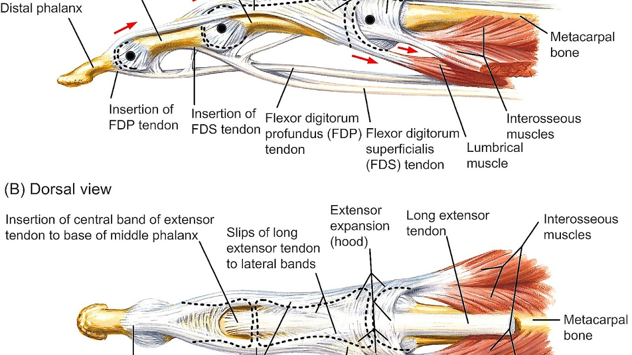 Central Slip Extensor Tendon Injury - Injury Choices