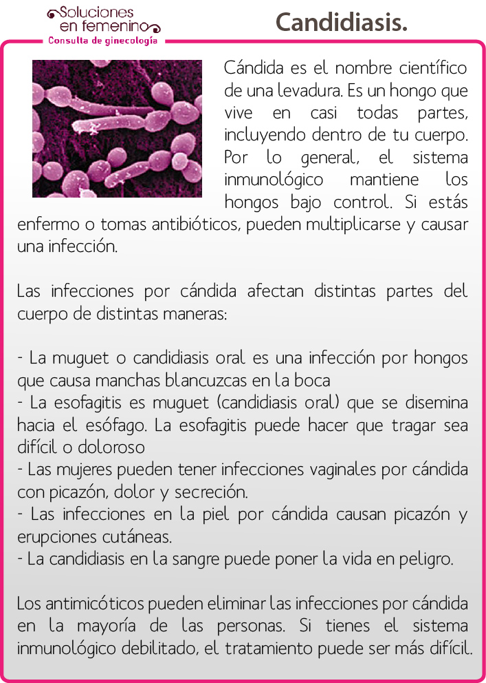 Soluciones en femenino: Píldoras de información 1. Infecciones por Candidiasis.