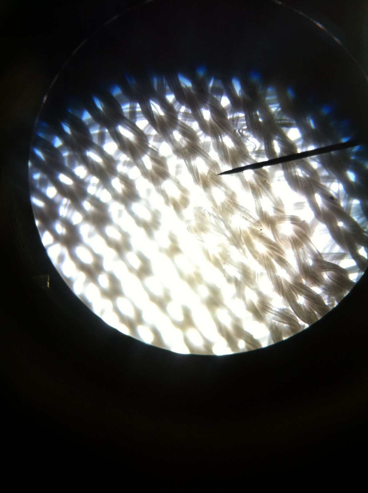 Forensics: Forensics Project Part II: Hair and Fiber Analysis Forensics: Forensics Project Part II: Hair and Fiber Analysis