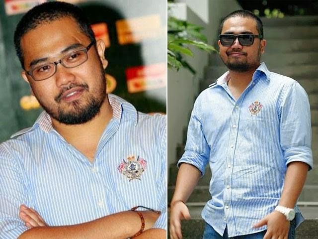 Johan Raja Lawak Selamat Menjalani Pembedahan Lutut | Armada Melayu™