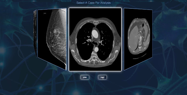 Different Usage of Picture Archiving and Communication System PACS