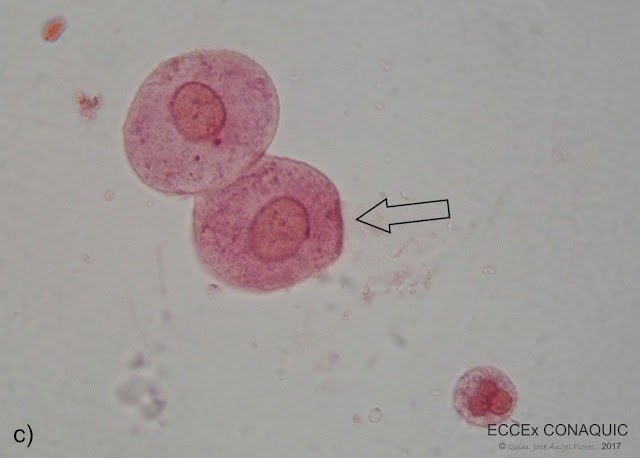 Examen General de Orina: junio 2017
