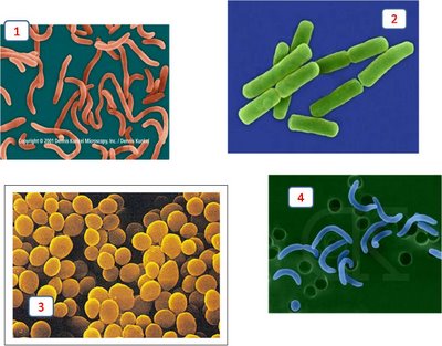 La magia de los OVNIS: Arqueobacterias
