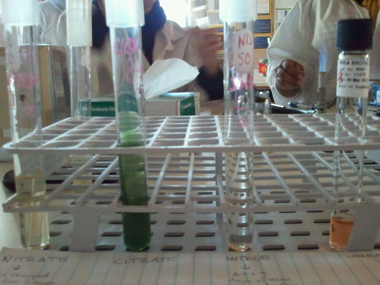 Microbiology Lab: Lab 11/8: Nitrate, Citrate, Urea, Indole