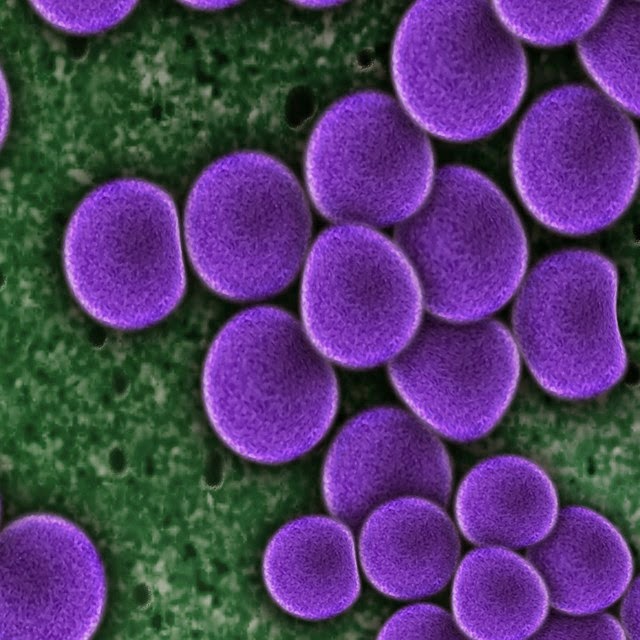 Inilah Penyebab Jerawat Bernanah Pada Wajah - EDUBIO