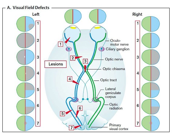 Ensayos de Medicina, otras cosas y la vida: Neuro-Oftalmología