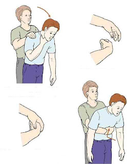 Primeros Auxilios IES San Blas Lucia FC: Asfixia