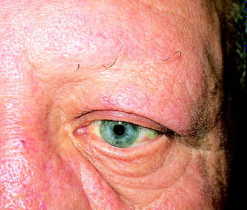 Case of the Day: Stigma