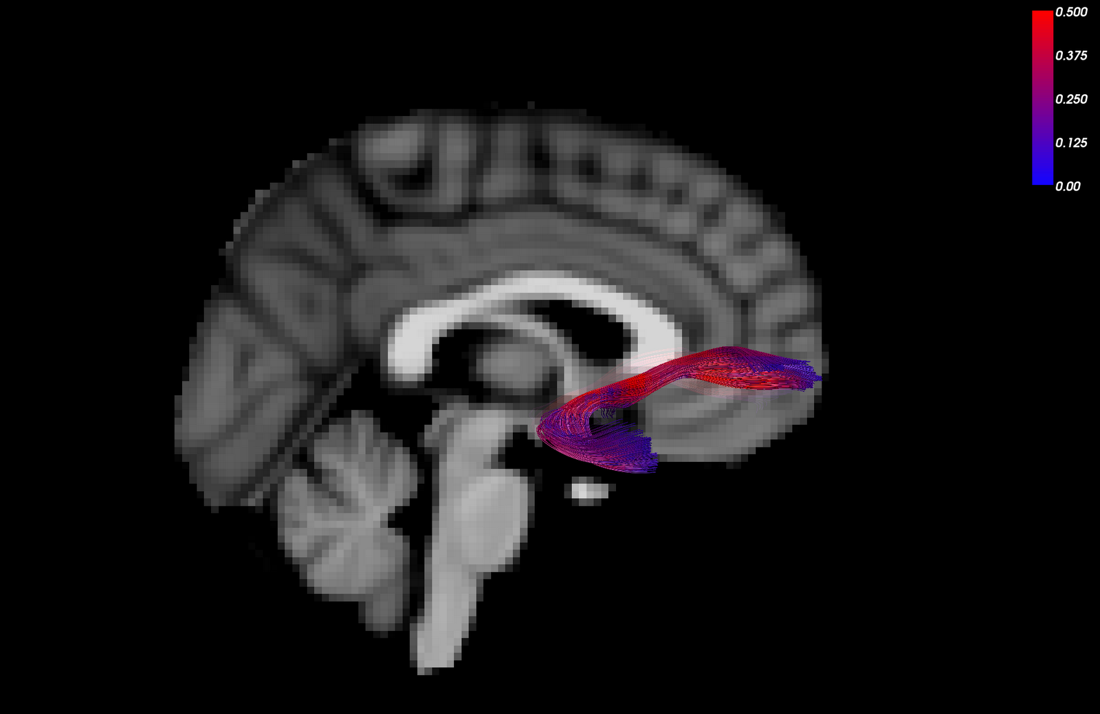 DTI Tutorial 3 - Fiber Tractography | Diffusion Imaging; Introduction ...