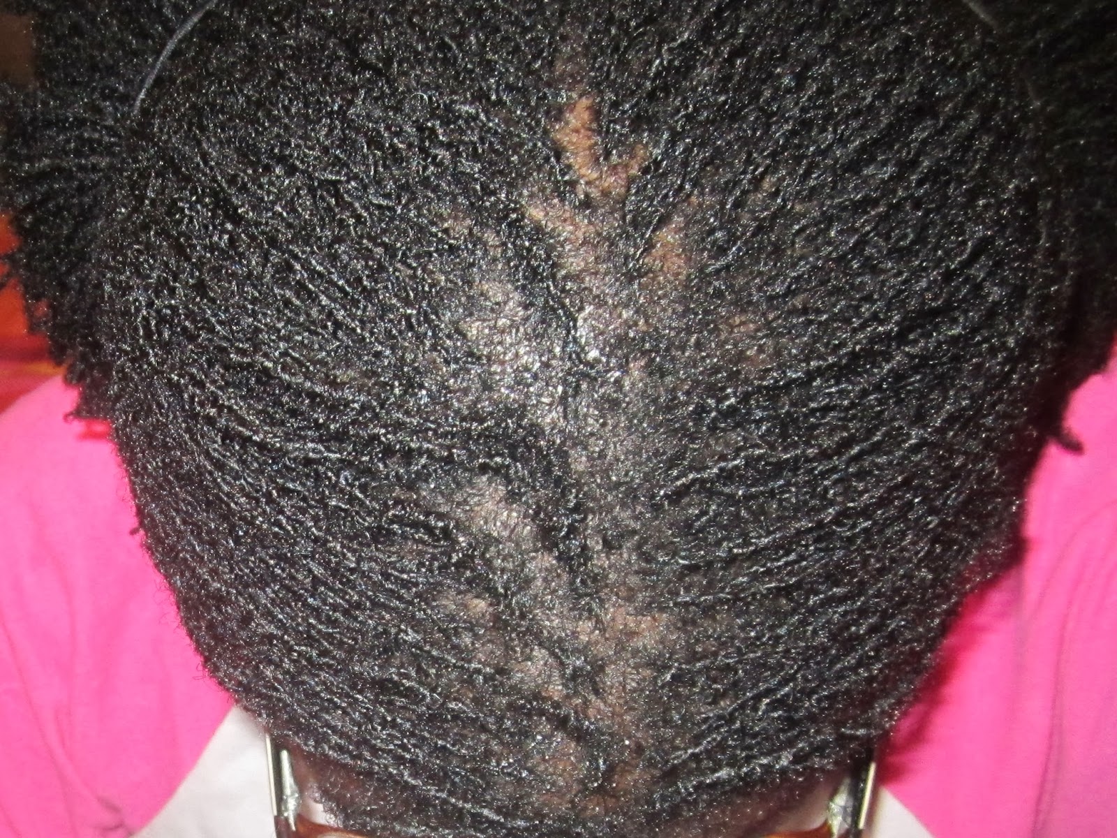 Kreyola's Journeys: Update: Healthy Regrowth & Sisterlocks Grid Restoration