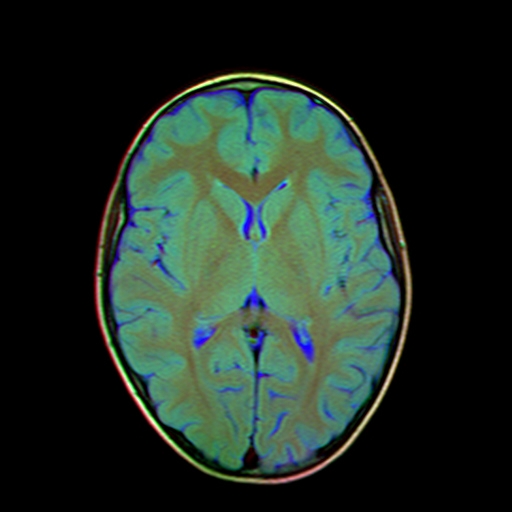 Nevit's blog: Color MRI of the Brain