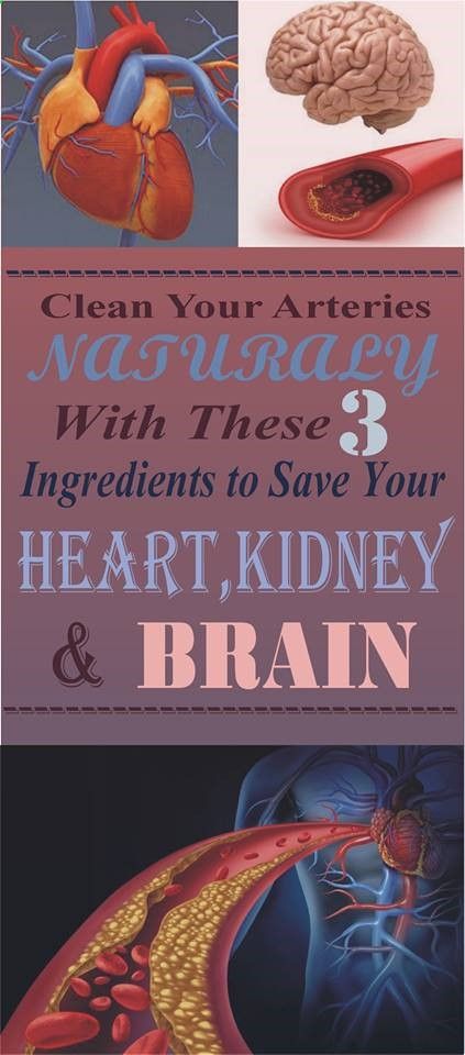 CLEAN YOUR ARTERIES NATURALLY WITH THESE 3 INGREDIENTS TO SAVE YOUR ...