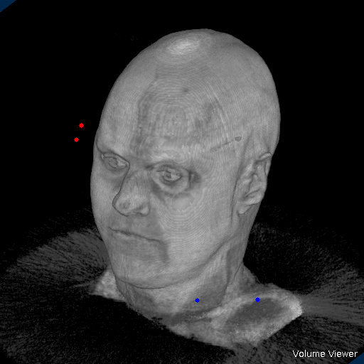 crazybiocomputing: Learning Tomography: WBP 3D reconstruction