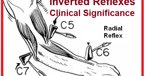 Brachioradialis Reflex