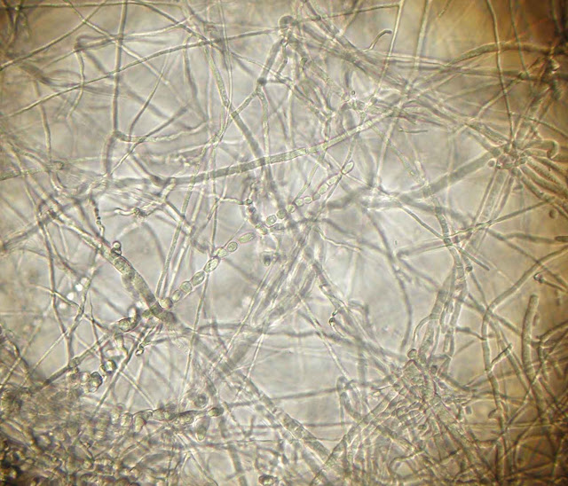 ATLAS MICOLOGIA: SCYTALIDIUM DIMIDIATUM (Neoscytalidium dimidiatum)