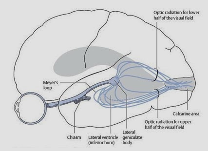 NERVUS OPTIKUS, Saraf Mata, 2nd Cranial Nerve Medical Articles