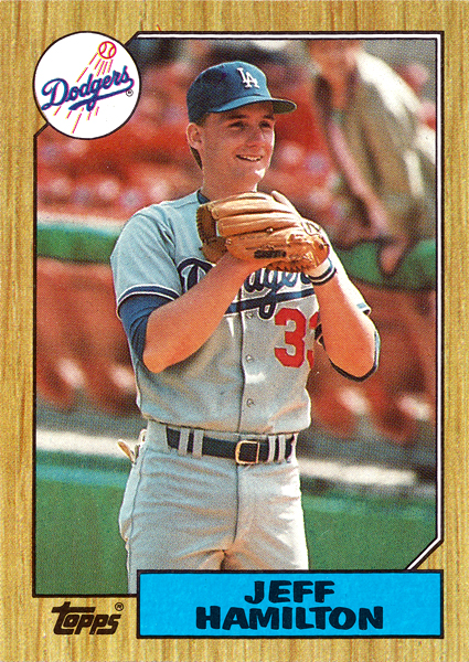 Top of the Topps: 1987 Topps: Part III
